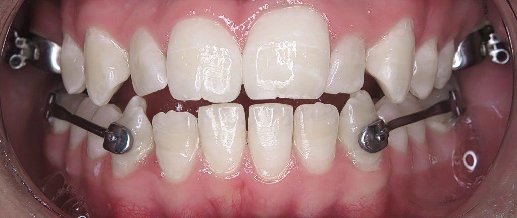 Apparaturen - KFO Langen