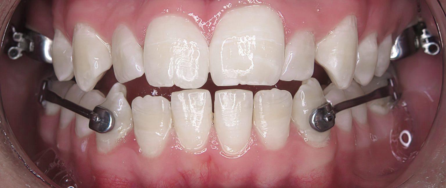 Apparaturen - KFO Langen