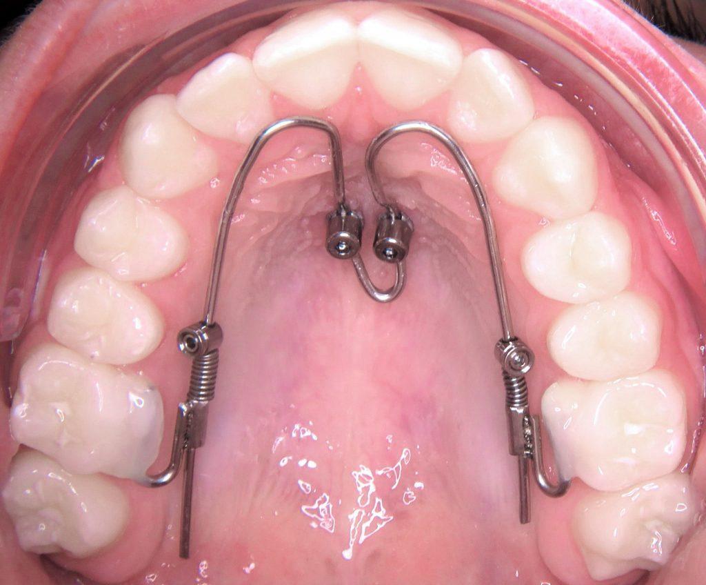 Apparaturen - KFO Langen