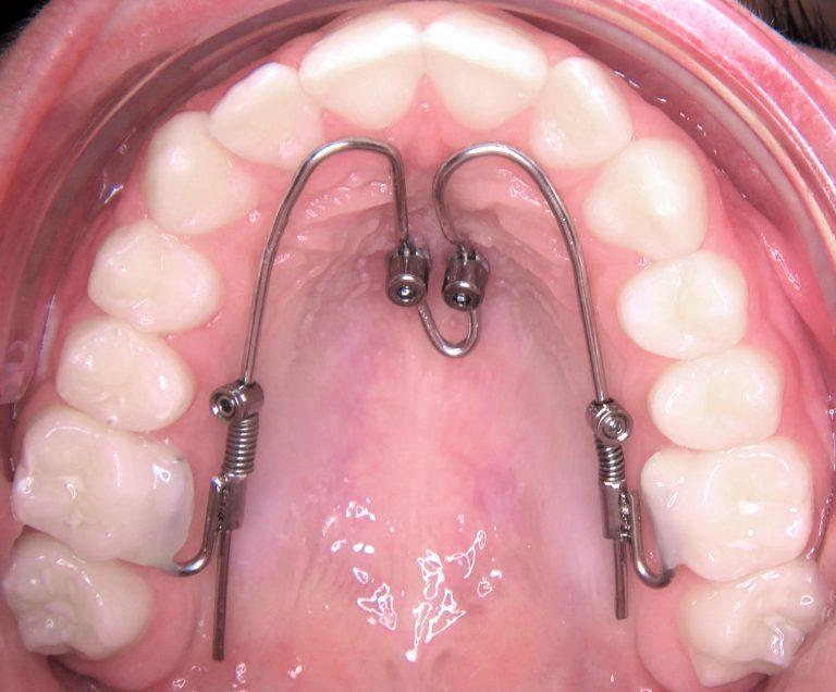 Apparaturen - KFO Langen