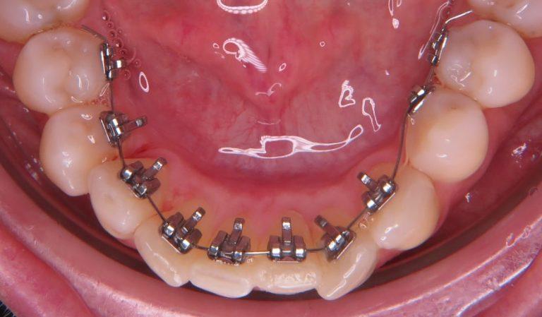 Apparaturen - KFO Langen
