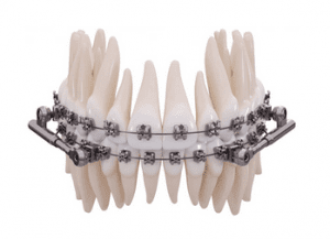 Apparaturen - KFO Langen