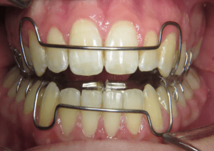 Apparaturen - KFO Langen